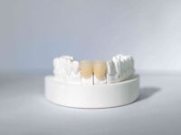Advanced Digital Dentistry Equipment for Full Contour Zirconia - RoboCrown